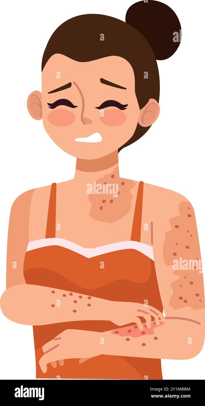 cute girl with monkeypox virus Stock Vector Image & Art - Alamy
