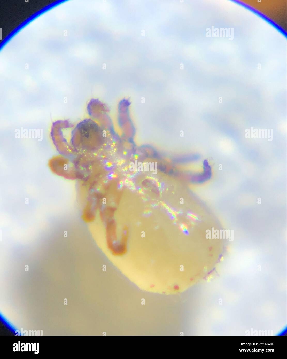 Mites and Ticks (Acari) Arachnida Stock Photo - Alamy