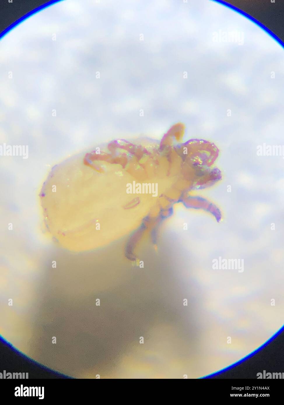 Mites and Ticks (Acari) Arachnida Stock Photo - Alamy