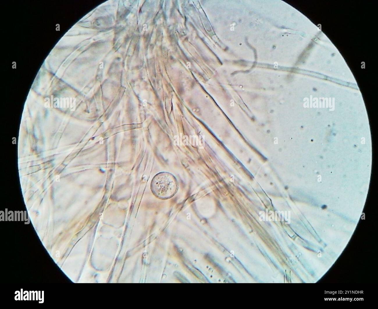 ebony cup (Pseudoplectania nigrella) Fungi Stock Photo - Alamy