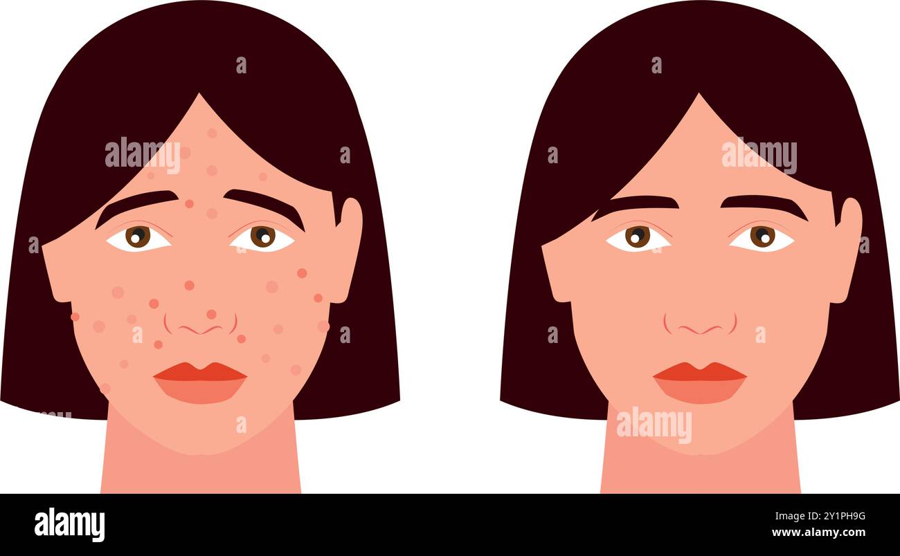 Without tissue Cut Out Stock Images & Pictures - Alamy