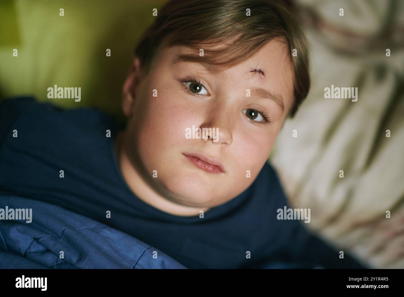 Little boy with macro sutures on forehead, kid resting in bed Stock ...