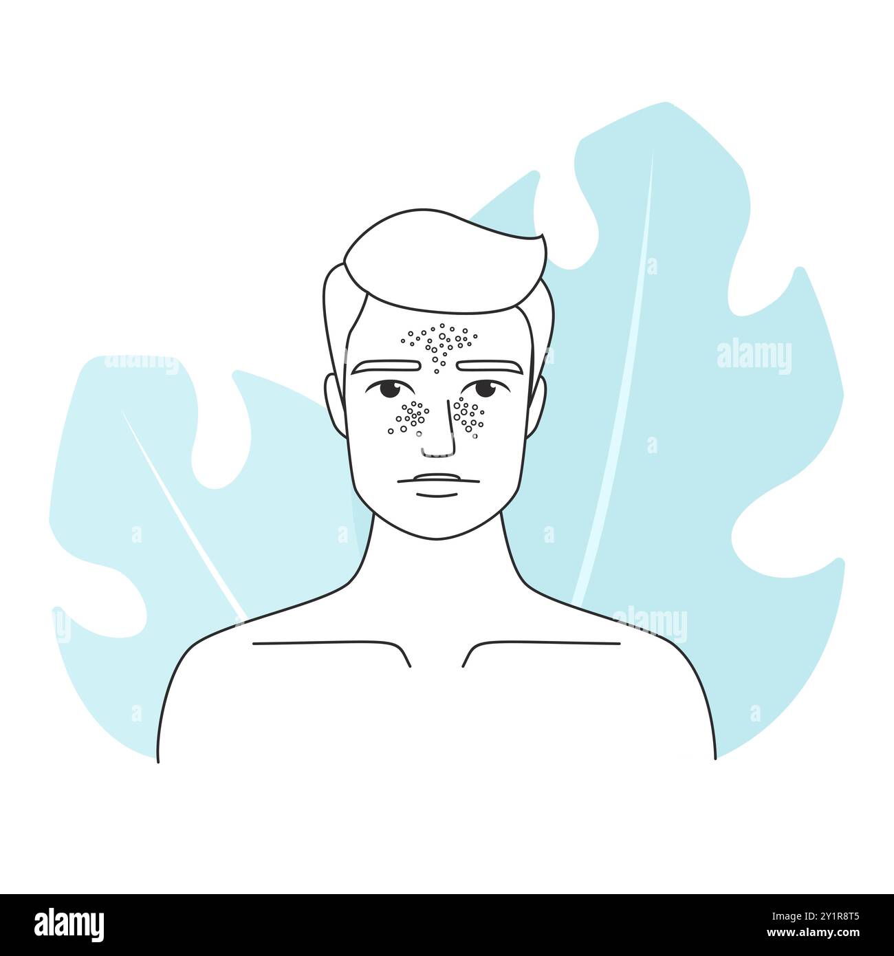 Line illustration of a man with melasma and hyperpigmentation. Skincare ...