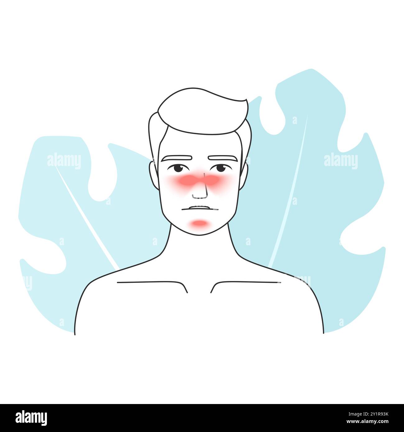 Vector illustration of a male portrait with rosacea and a light blue ...