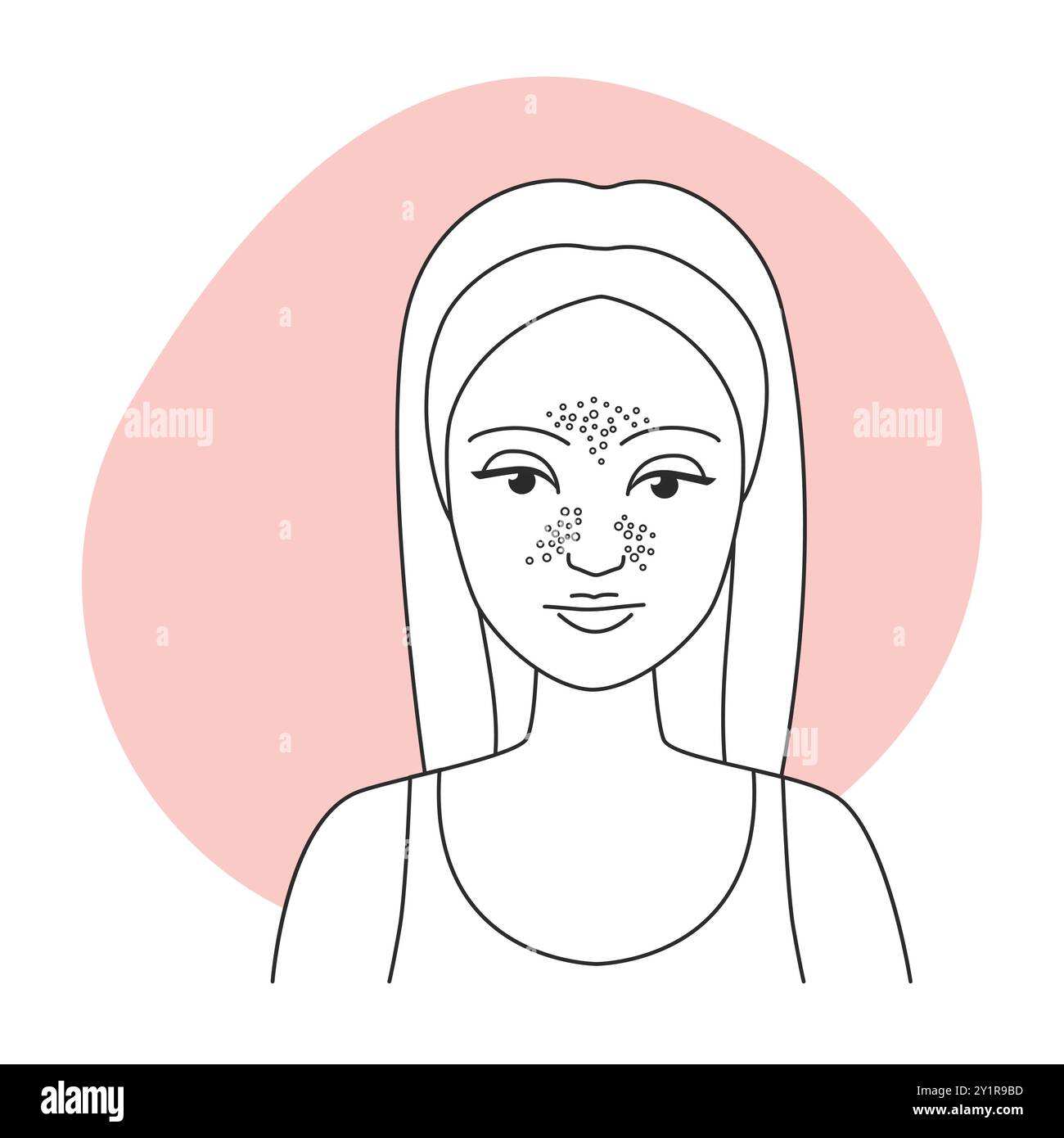 Vector illustration of a female portrait with blackheads and a light pink background Stock ...