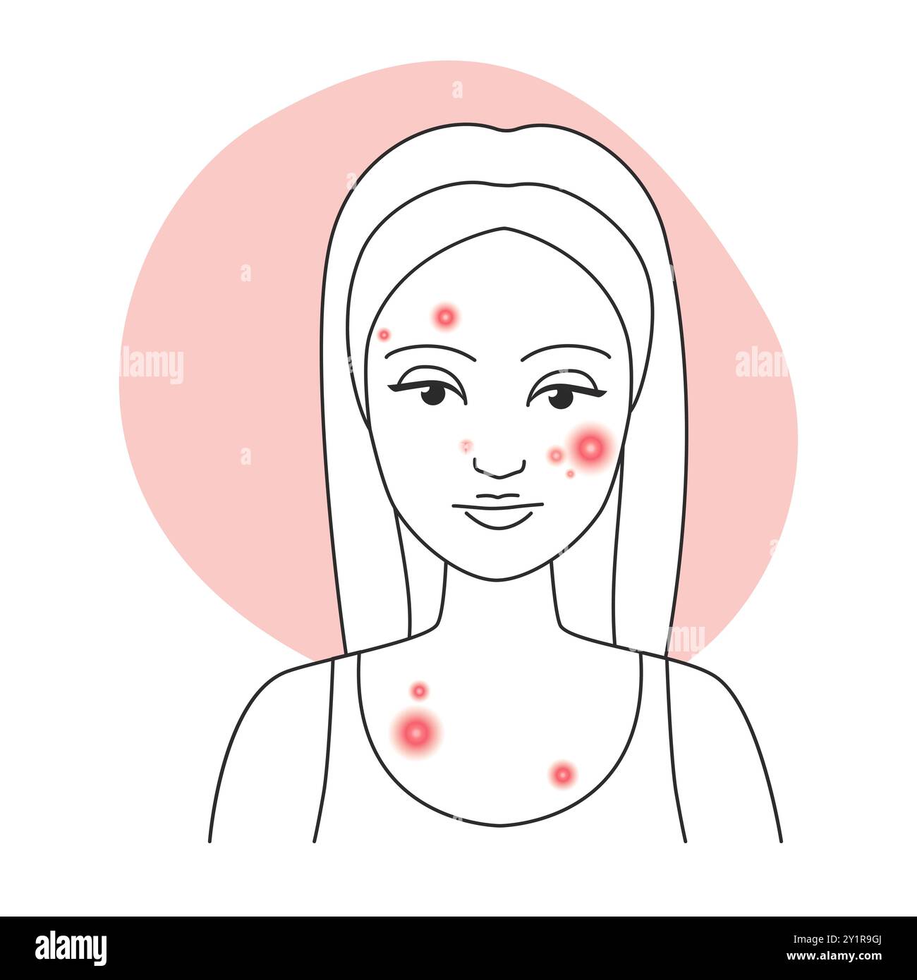 Vector illustration of a female portrait with acne and a light pink ...