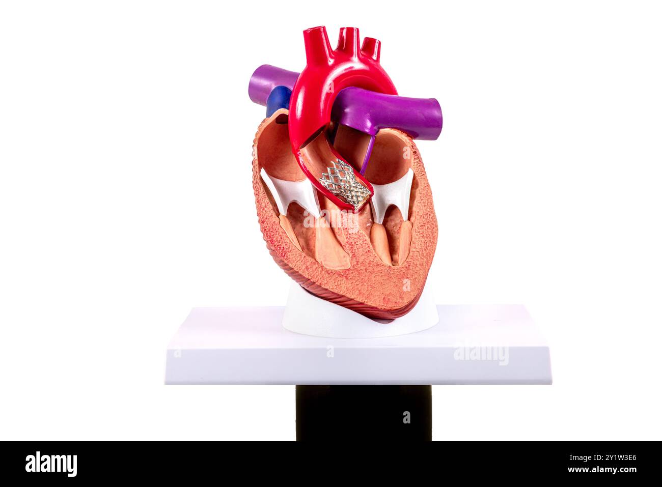Cardiac model of Transcatheter aortic valve implantation (TAVI) for ...