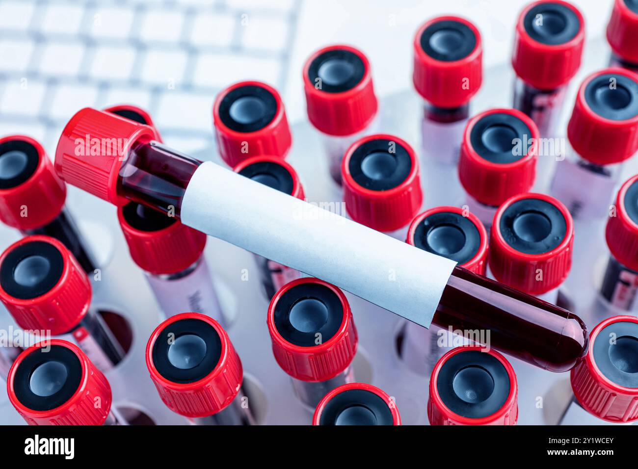 One sample tube with blood and blank label on others, closeup ...