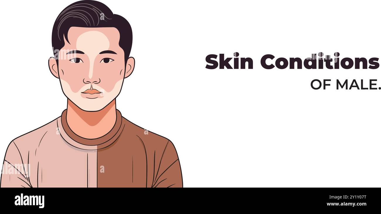 Illustration of skin conditions affecting a male, focusing on common ...