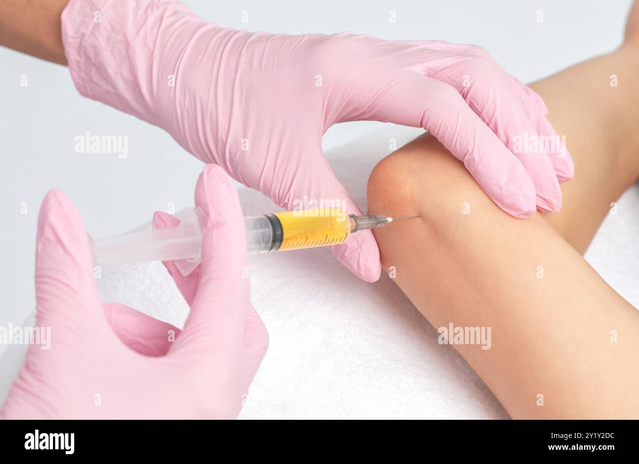 Doctor doing stem cell therapy on a patient's elbow after the injury. Treating knee pain with ...