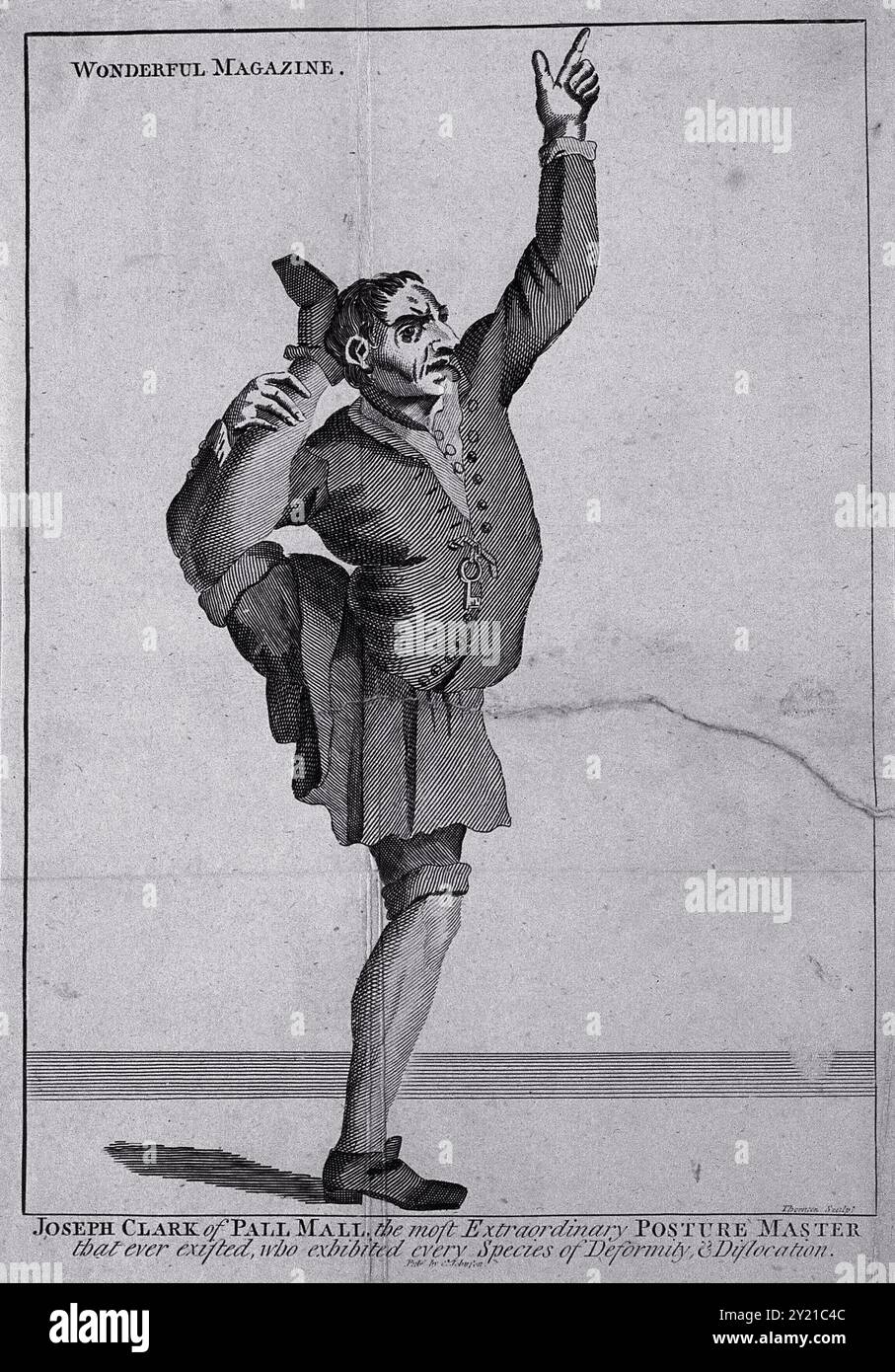 Joseph Clark, a celebrated contortionist, demonstrates an extraordinary ...