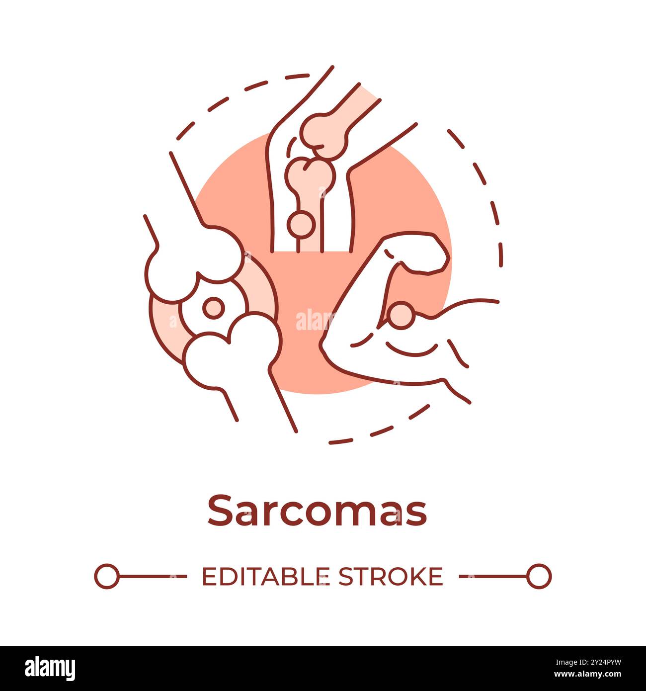 Soft tissue sarcoma hi-res stock photography and images - Alamy