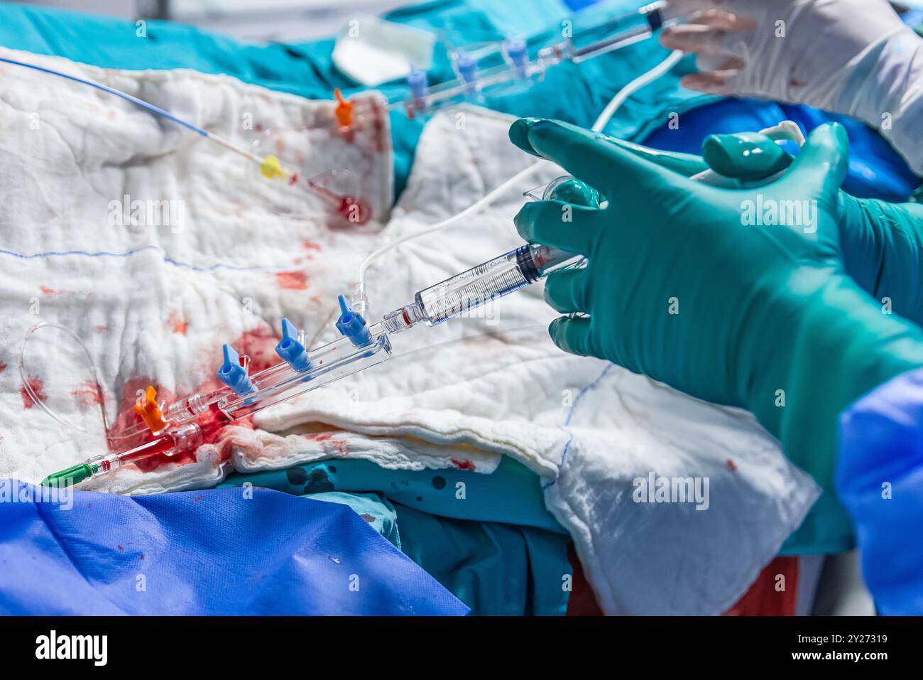 Inserting central venous catheter hi-res stock photography and images ...