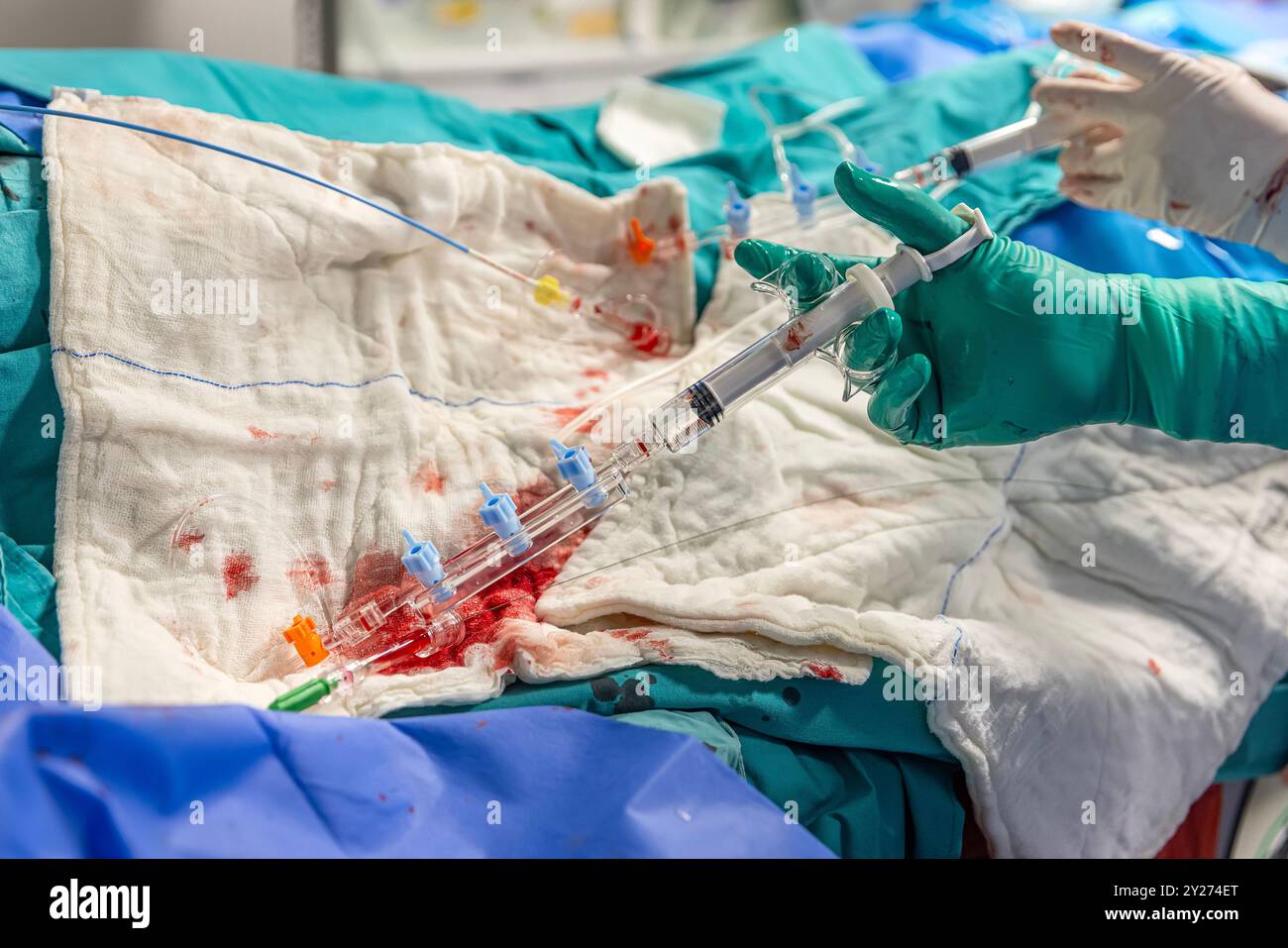 The procedure of inserting a double lumen catheter into a patient with ...