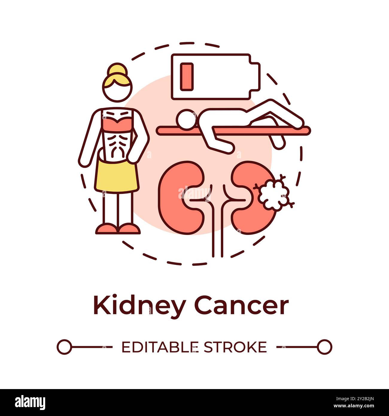 Malignant kidney Stock Vector Images - Alamy