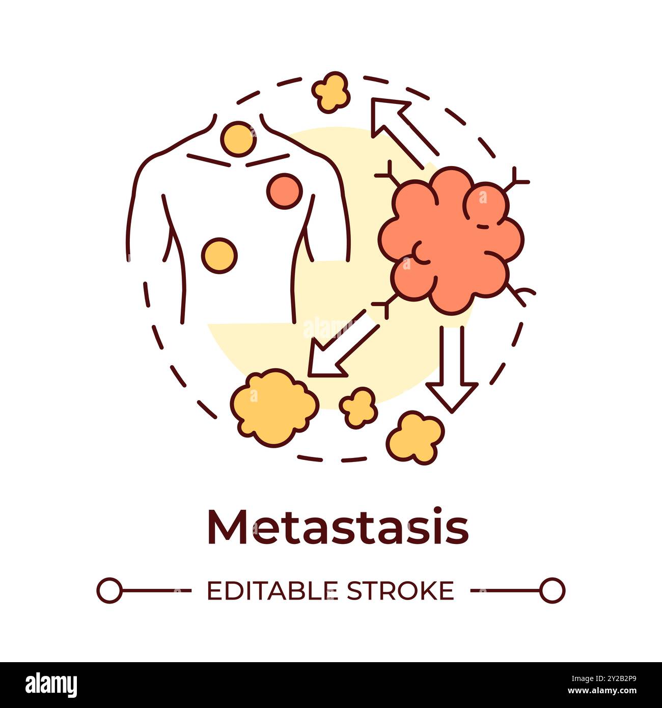 Cancer spreading Stock Vector Images - Alamy