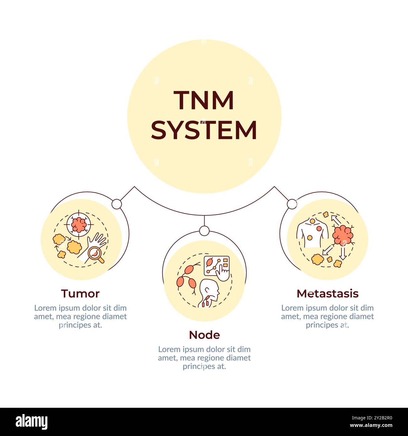 Tnm system hi-res stock photography and images - Alamy