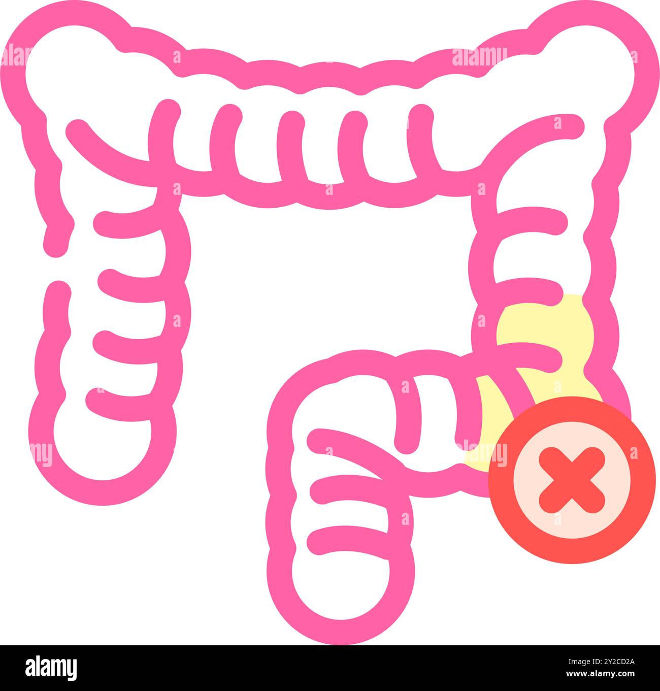 bowel resection surgery color icon vector illustration Stock Vector ...