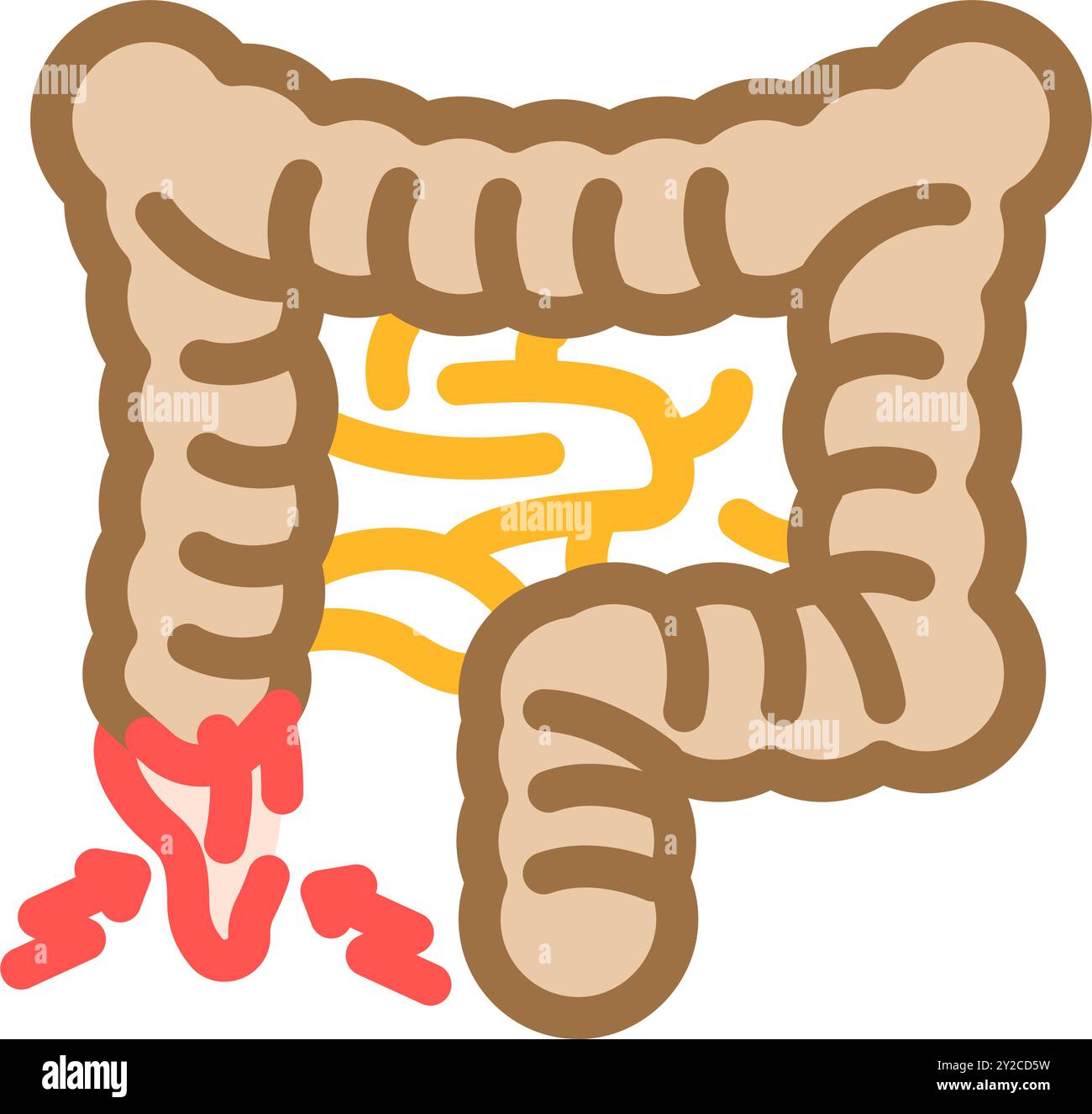 appendectomy surgery color icon vector illustration Stock Vector Image ...