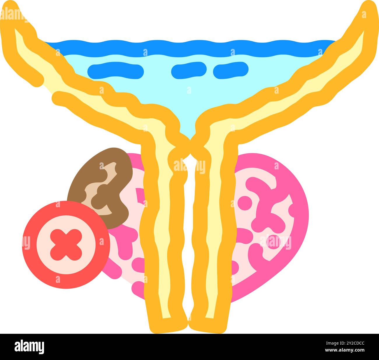 Prostatectomy Stock Vector Images - Alamy