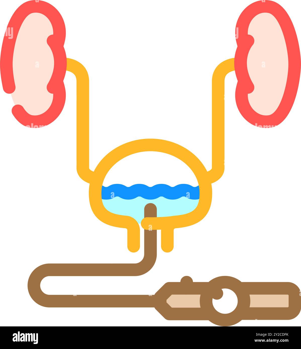 Ureteroscopy hi-res stock photography and images - Alamy