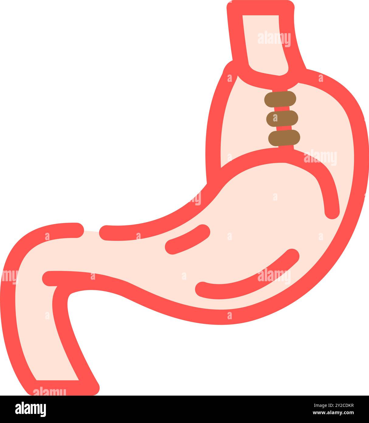 Fundoplication hi-res stock photography and images - Alamy