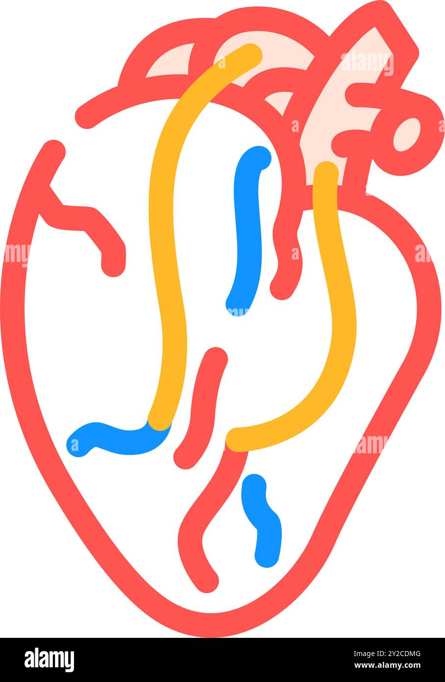 heart bypass surgery color icon vector illustration Stock Vector Image ...