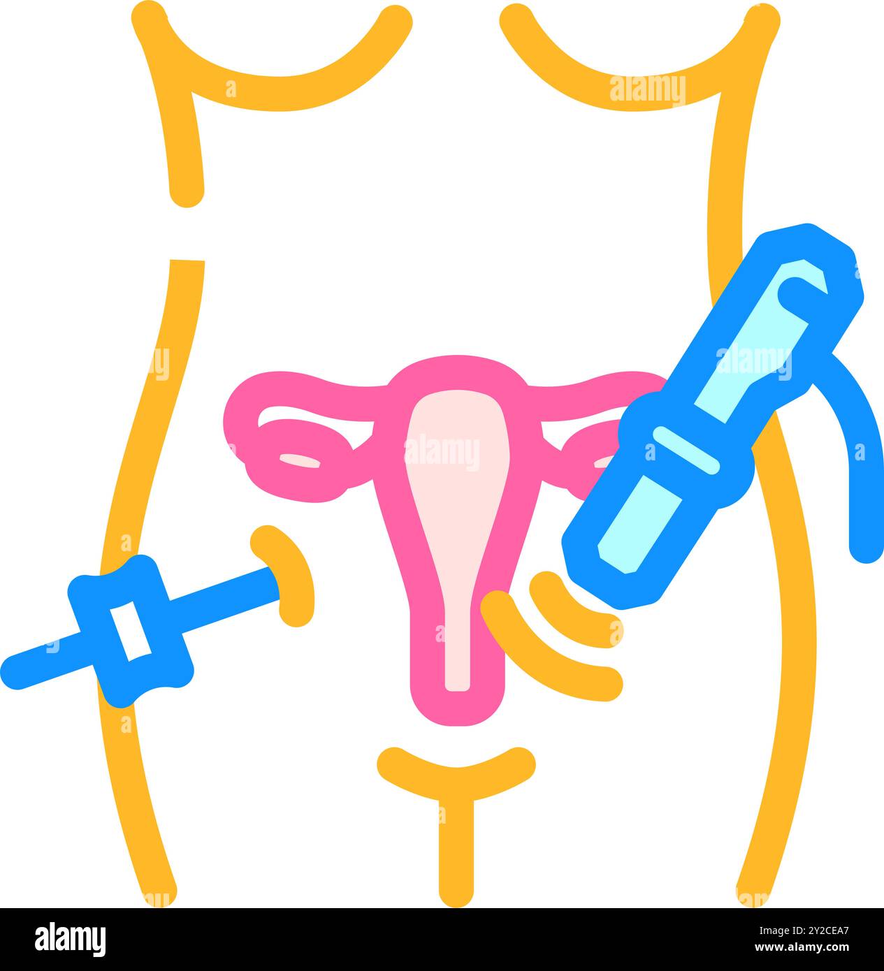 gynecologic laparoscopy surgery color icon vector illustration Stock ...