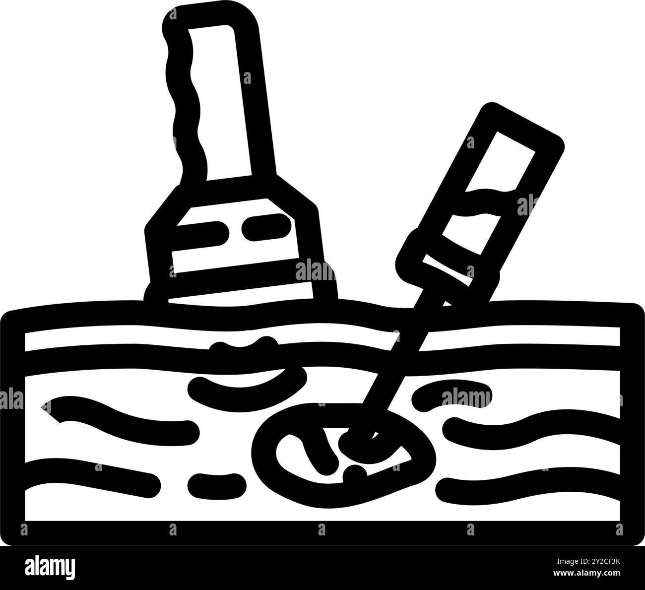 Laparoscopic surgery black Stock Vector Images - Alamy