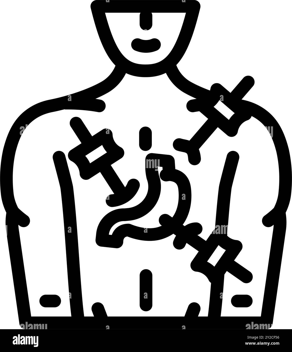 laparoscopy surgery line icon vector illustration Stock Vector Image ...