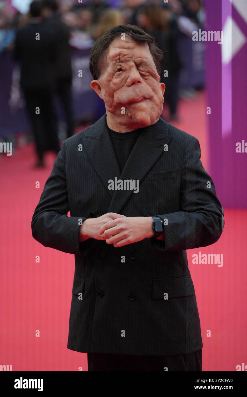 Actor adam pearson hi-res stock photography and images - Alamy