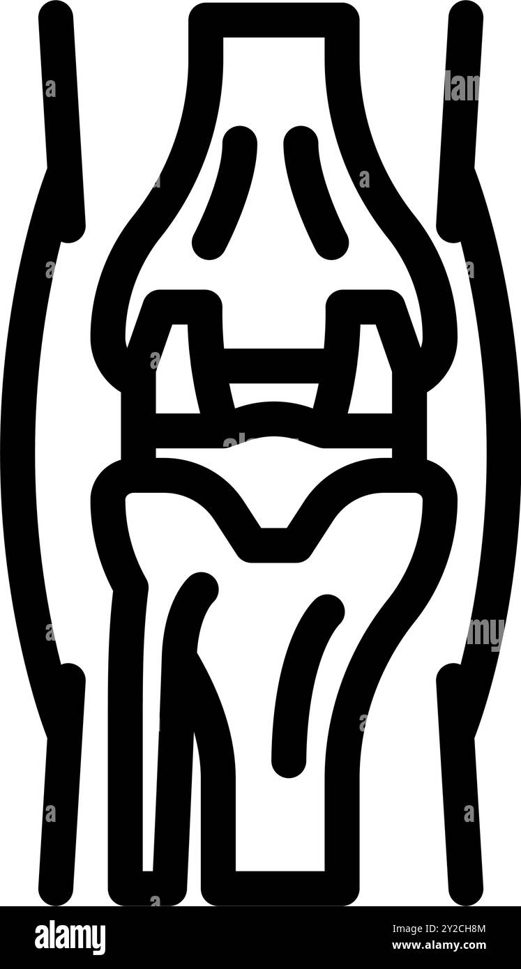 Joint resection hi-res stock photography and images - Alamy