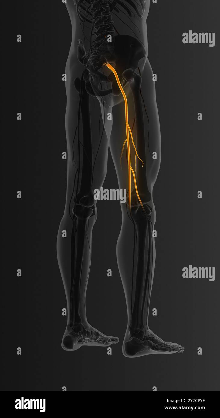 Sciatic nerve pain lower back through hips to leg Stock Photo - Alamy