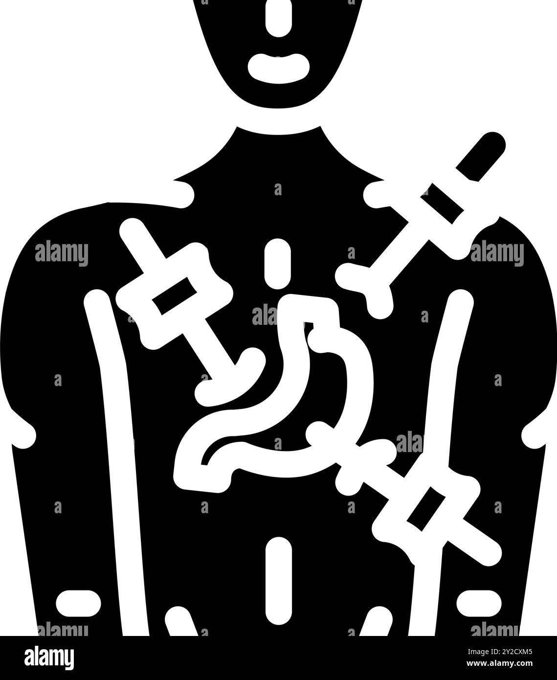 laparoscopy surgery glyph icon vector illustration Stock Vector Image ...