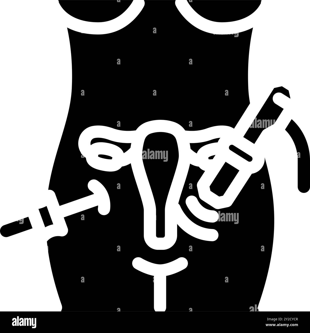 gynecologic laparoscopy surgery glyph icon vector illustration Stock ...