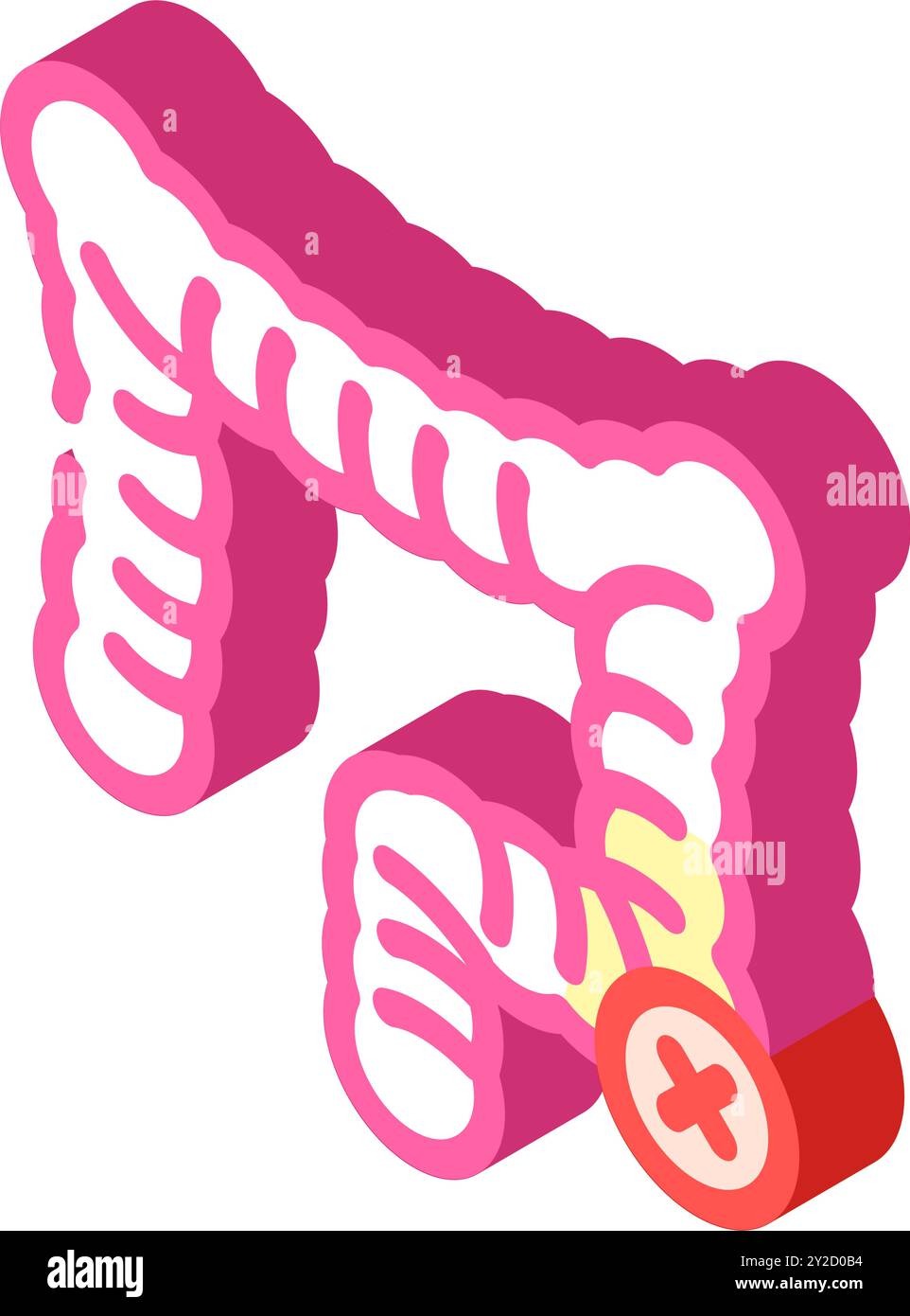 bowel resection surgery isometric icon vector illustration Stock Vector ...