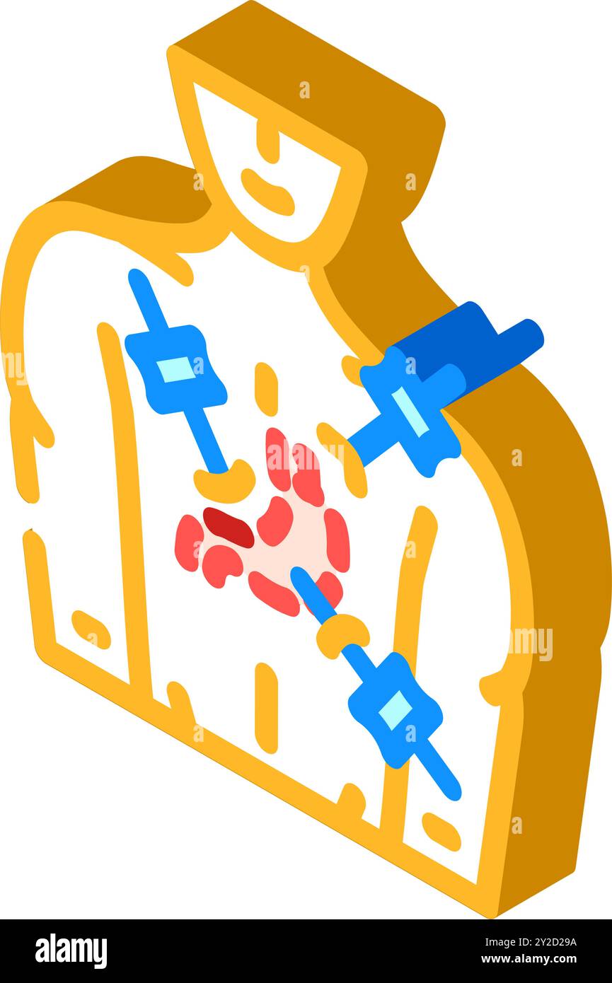 laparoscopy surgery isometric icon vector illustration Stock Vector ...