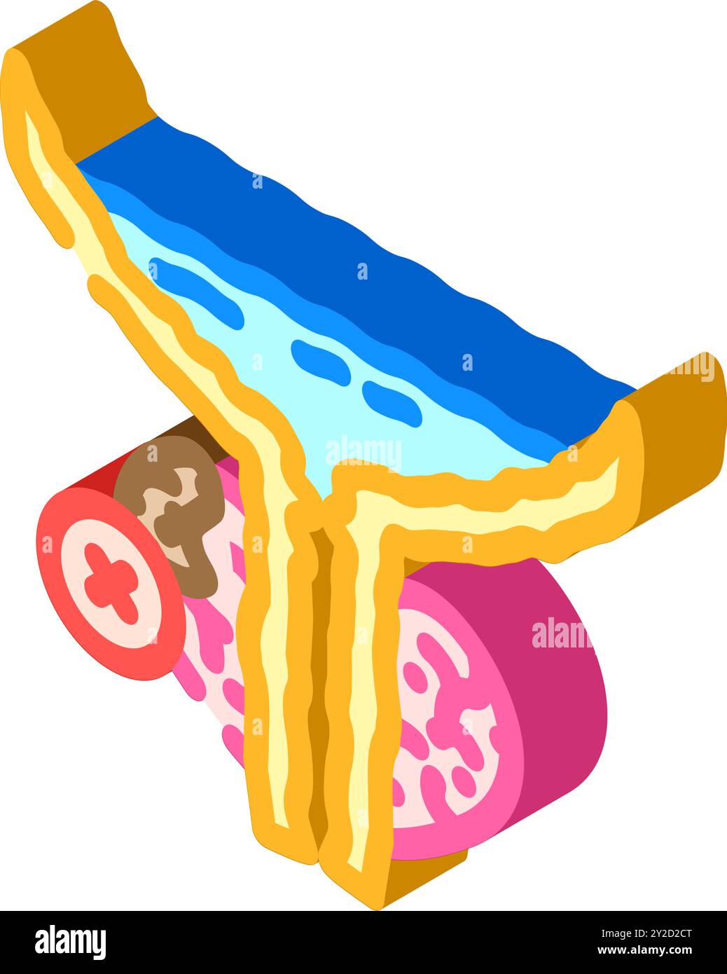 prostatectomy surgery isometric icon vector illustration Stock Vector ...