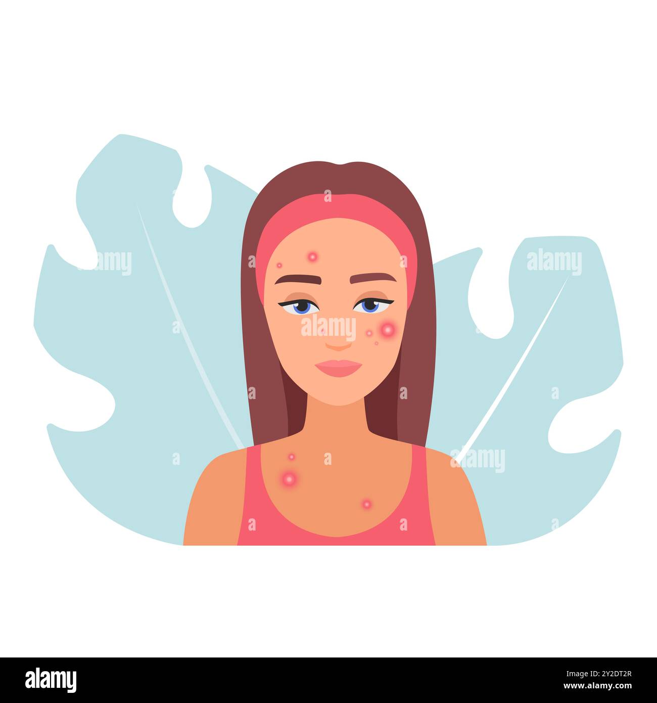 Illustration of a woman with acne and pimple problems. Skincare issue ...