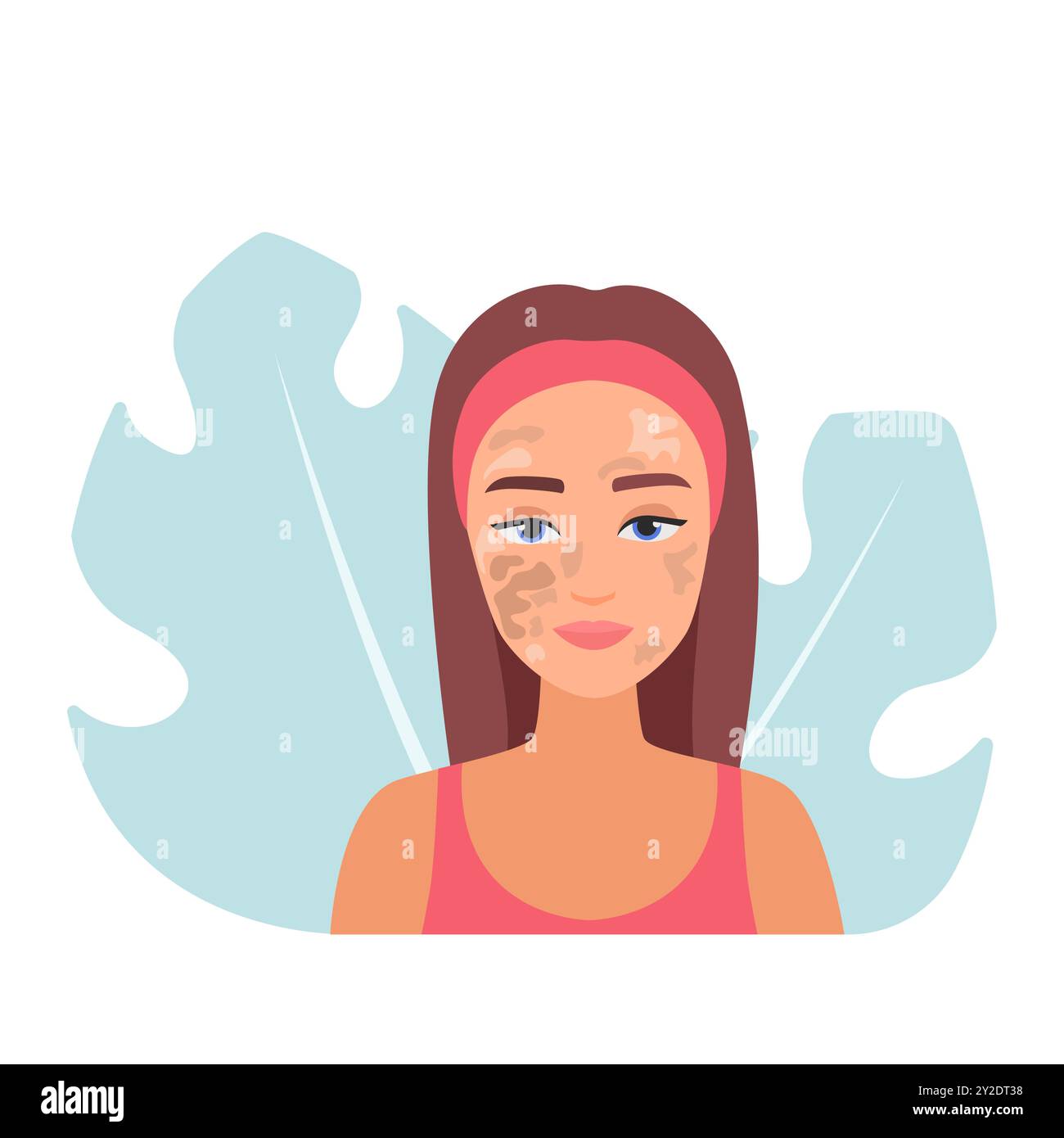 Illustration of a woman with melasma and hyperpigmentation. Skincare ...