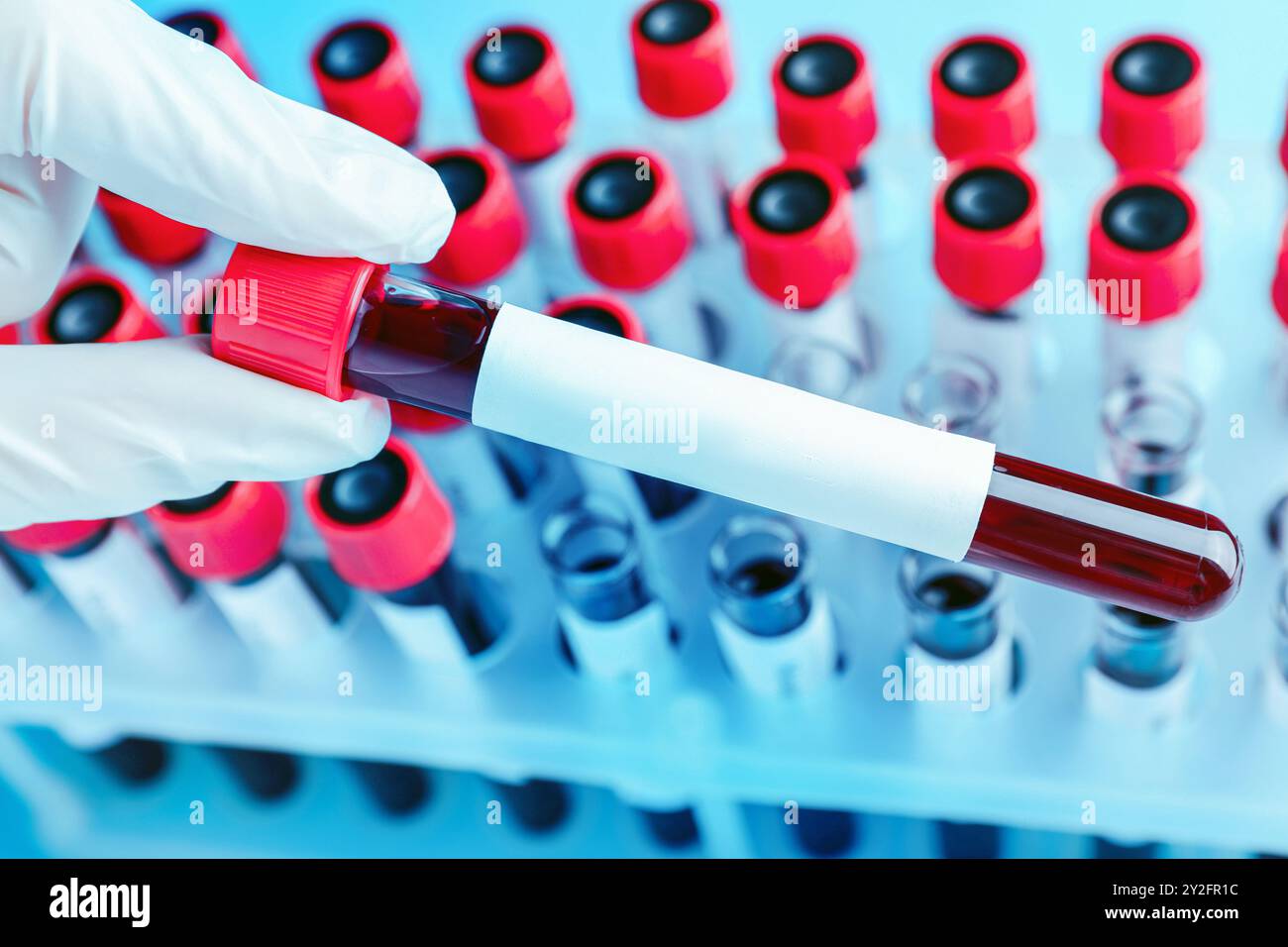 Laboratory worker putting sample tube with blood and blank label over ...