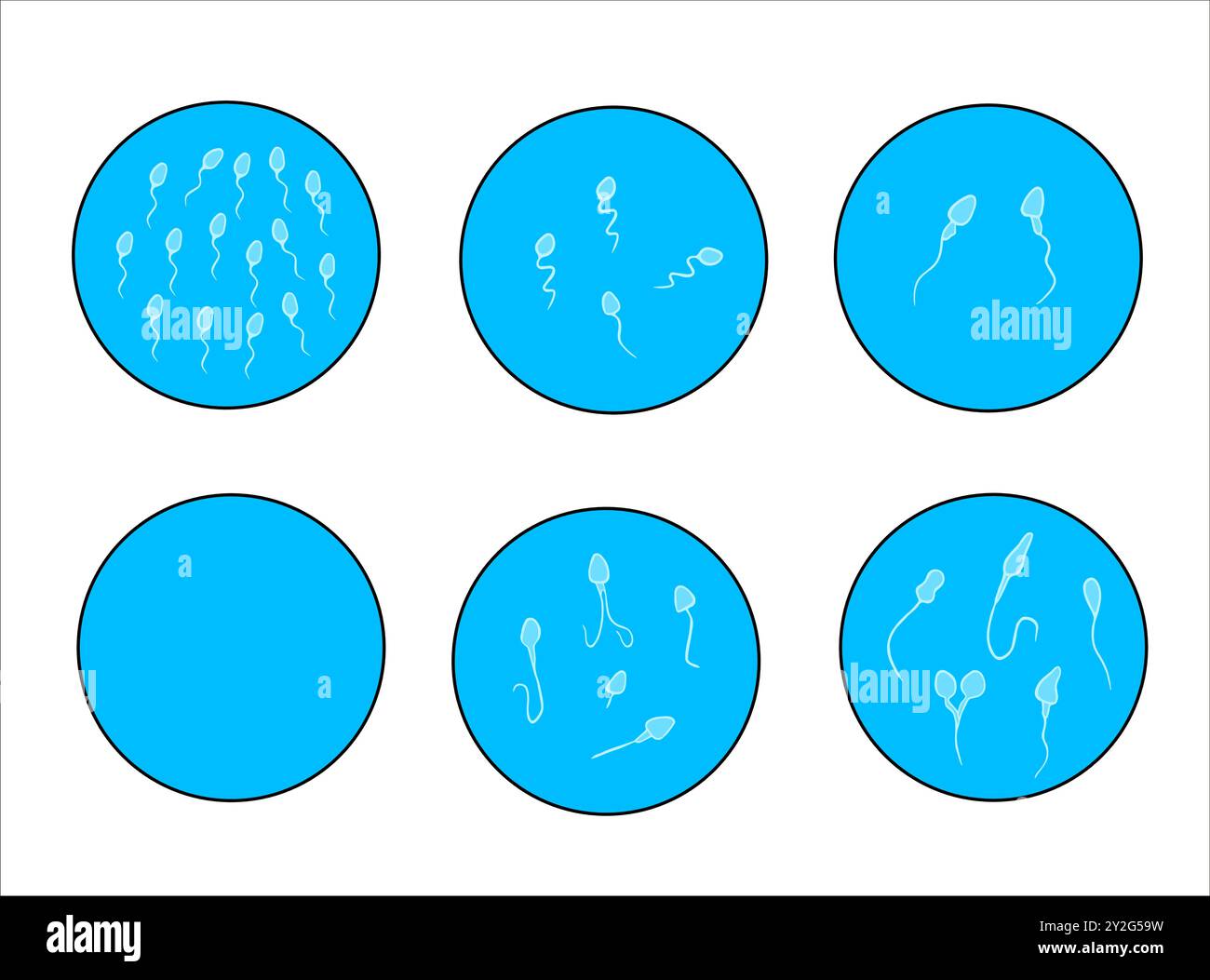 Vector isolated illustration of sperm pathologies. Spermogram. Sperm ...