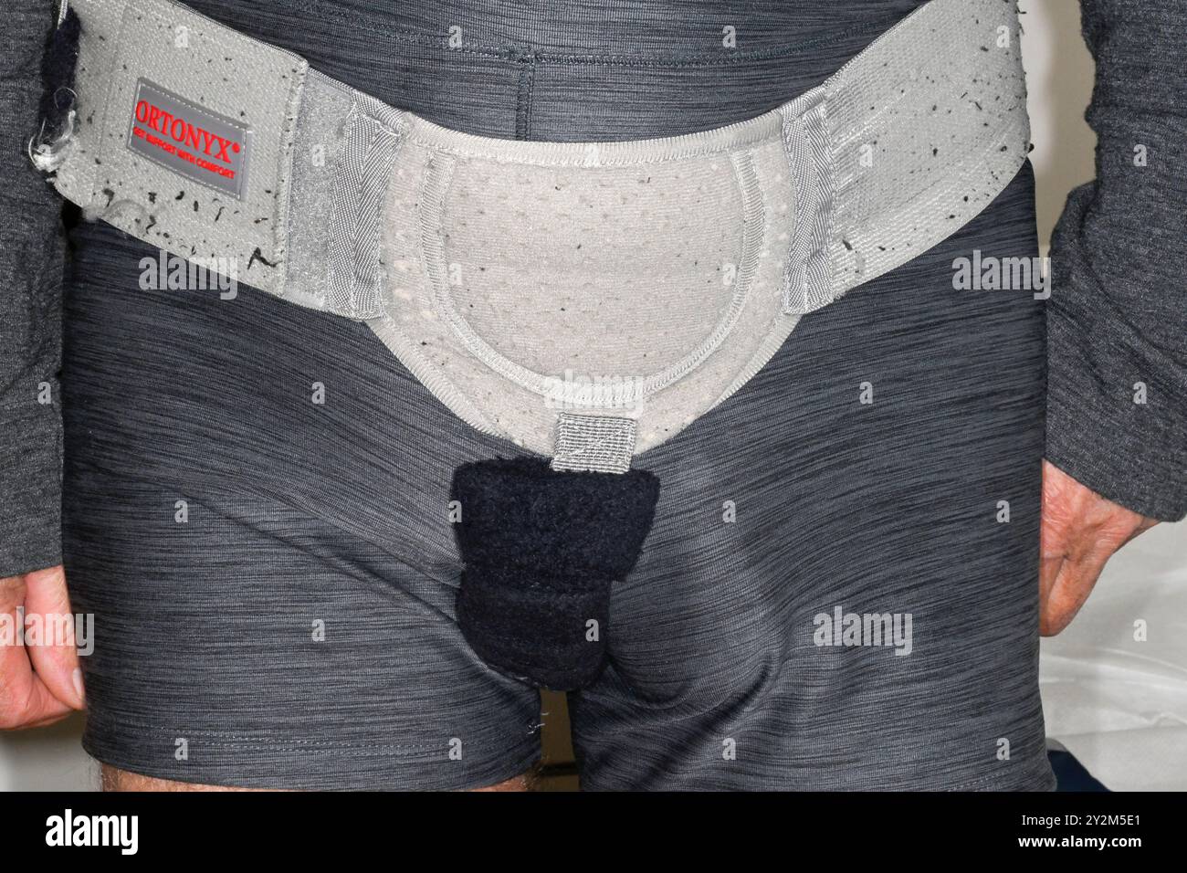 Truss worn by a 77 year old male patient with a large right inguinal ...