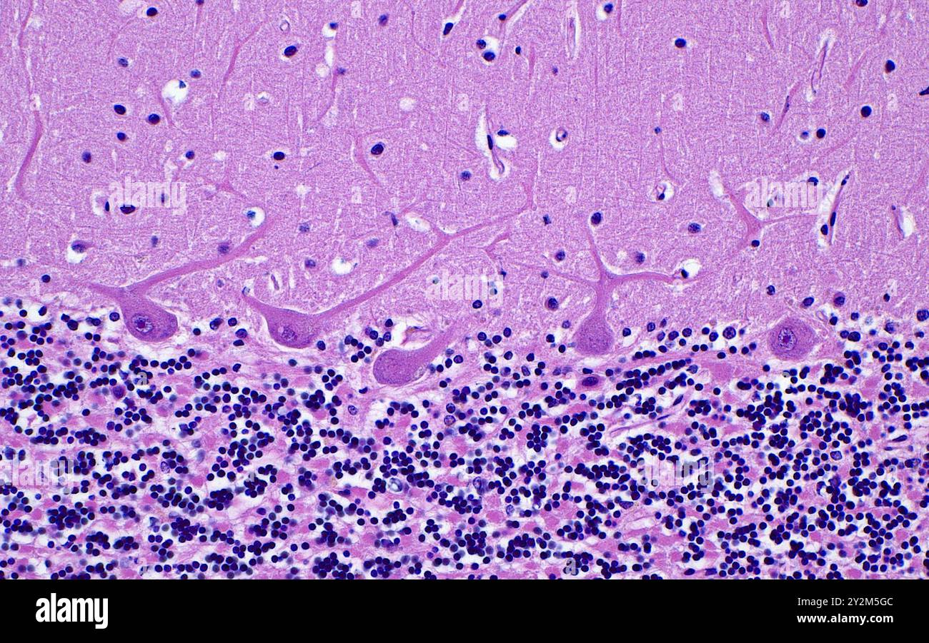 Light micrograph of cerebellum Purkinje neurons. The distinctive ...