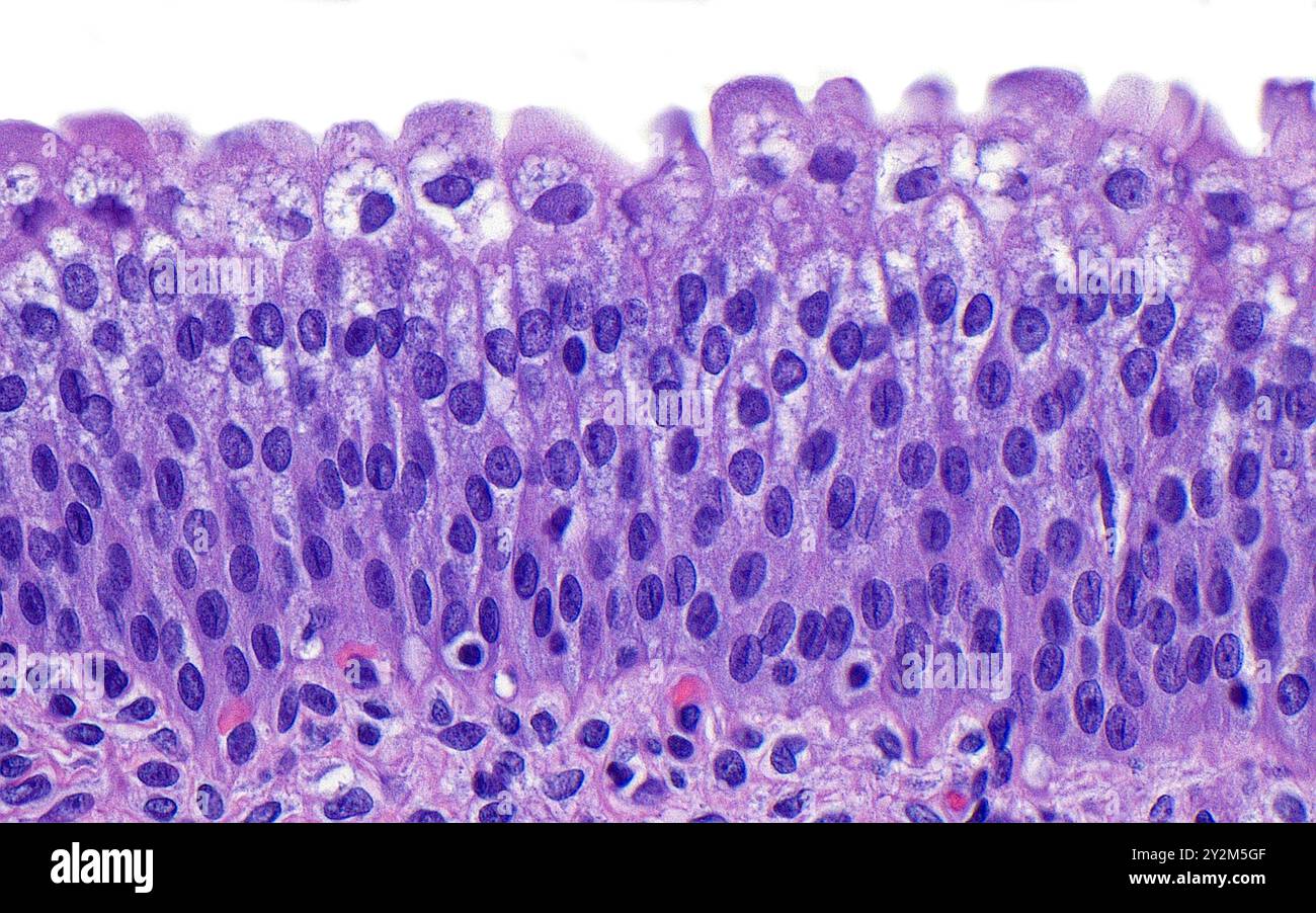Light micrograph of benign urothelium. Urothelium is composed of ...