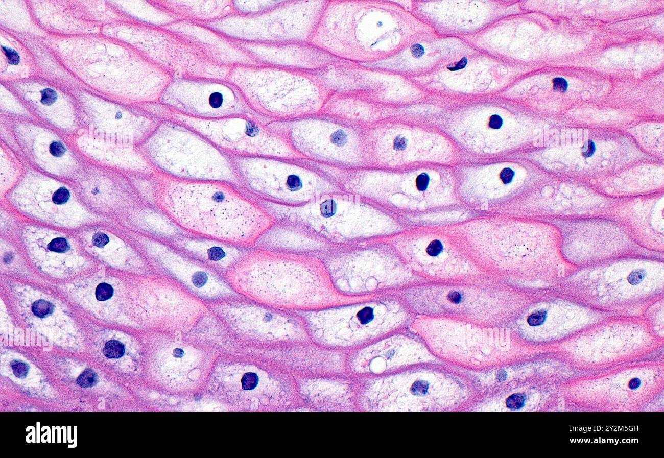 Light micrograph of squamous cells of the cervix. These squamous cells ...