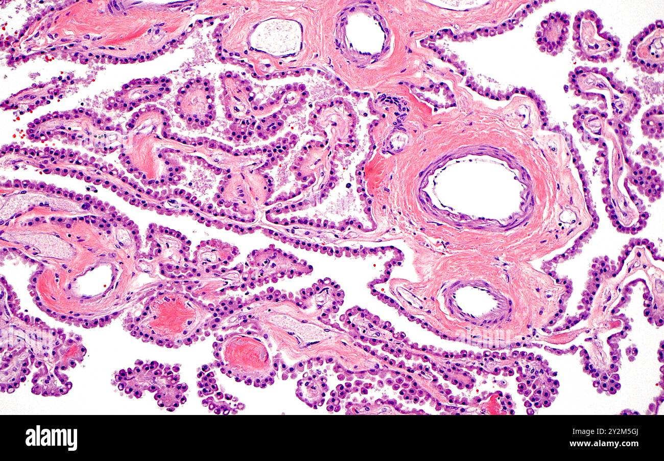 Light micrograph of choroid plexus. The choroid plexus is responsible ...