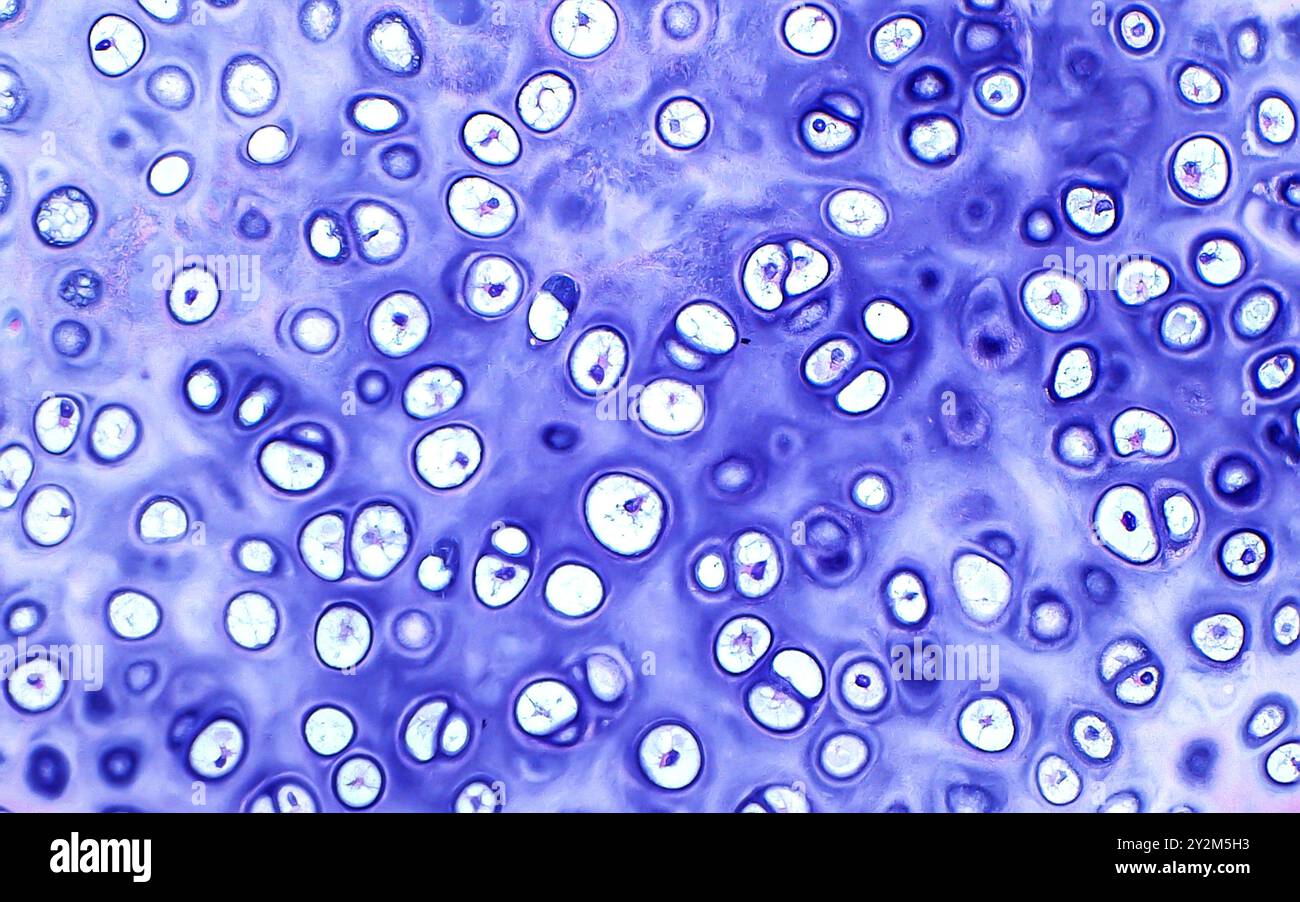 Light micrograph of hyaline cartilage. Hyaline cartilage (this example ...