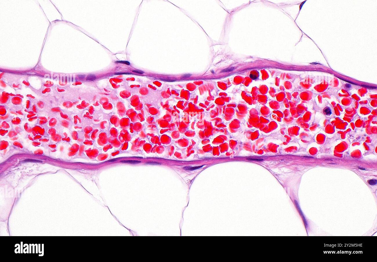 Light micrograph of a blood vessel. This small blood vessel is composed ...