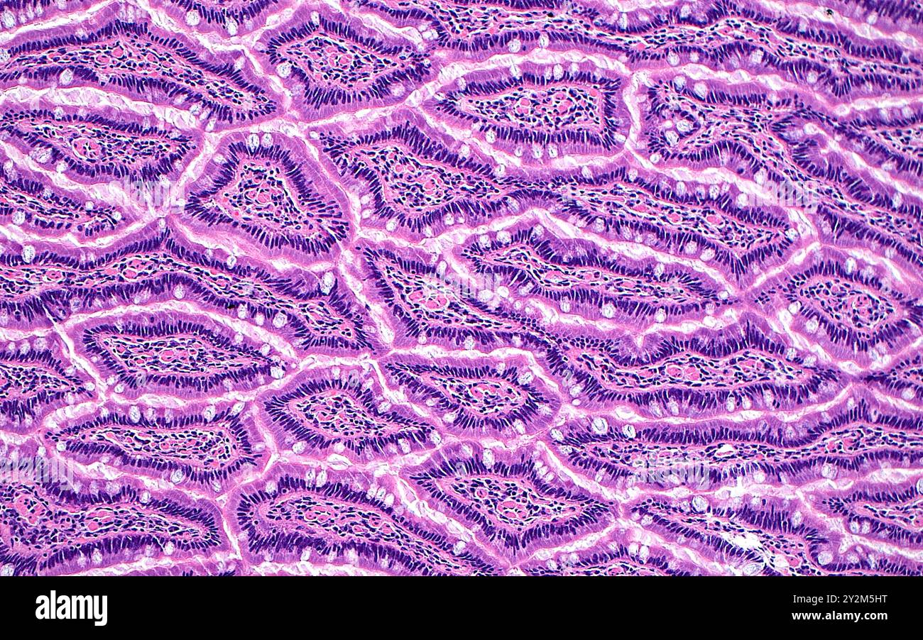 Light micrograph of a section of duodenal villi. The duodenal villous ...